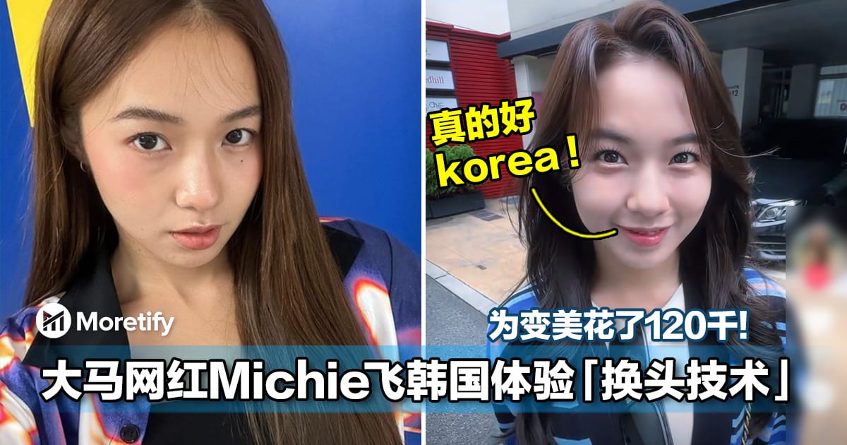 大马网红Michie飞韩国体验「换头技术」！为变美花了120千韩元！