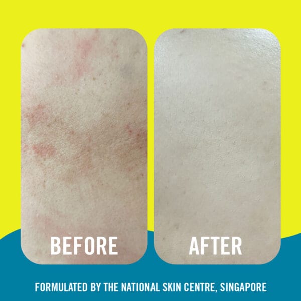 限量招募50位免费试用员！Vytle送你试用套装还有额外的TNG奖励！